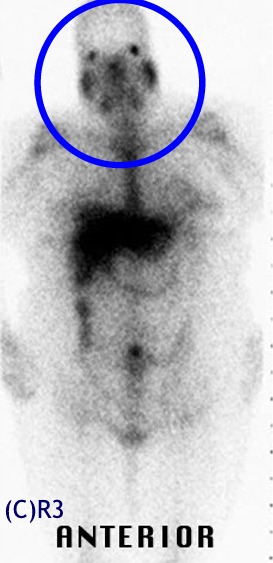 Welcome to LearningRadiology - radiology, radiologic, imaging, sign ...