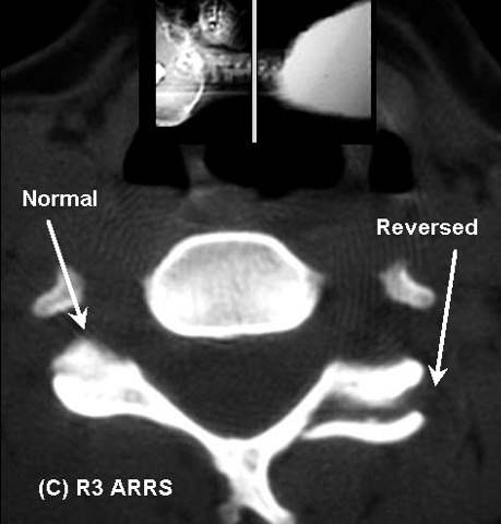 Welcome to LearningRadiology - radiology, radiologic, imaging, sign ...