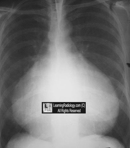 Welcome to LearningRadiology - radiology, radiologic, imaging, sign ...